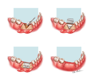 Professional freelance medical illustrator